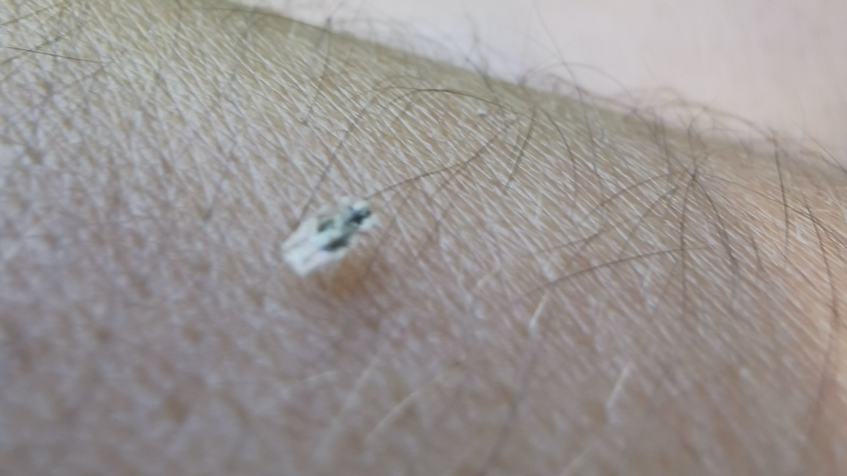 Dosadne su kao stjenice: Zagrepčane ponovno opsjedaju prozirne bubice ...